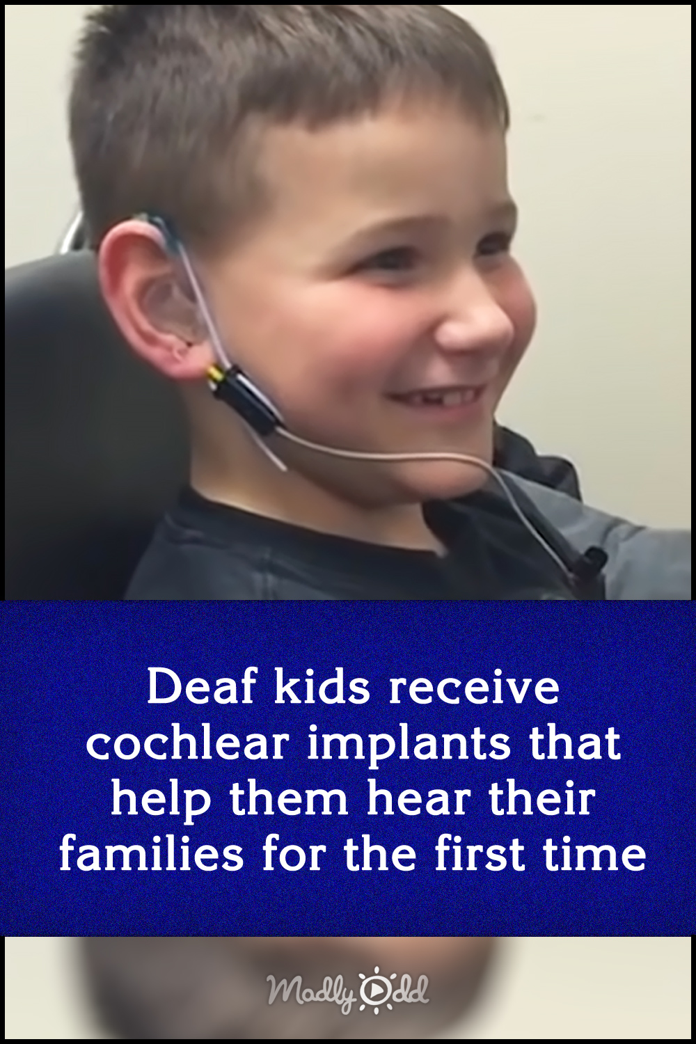 Deaf kids receive cochlear implants that help them hear their families ...